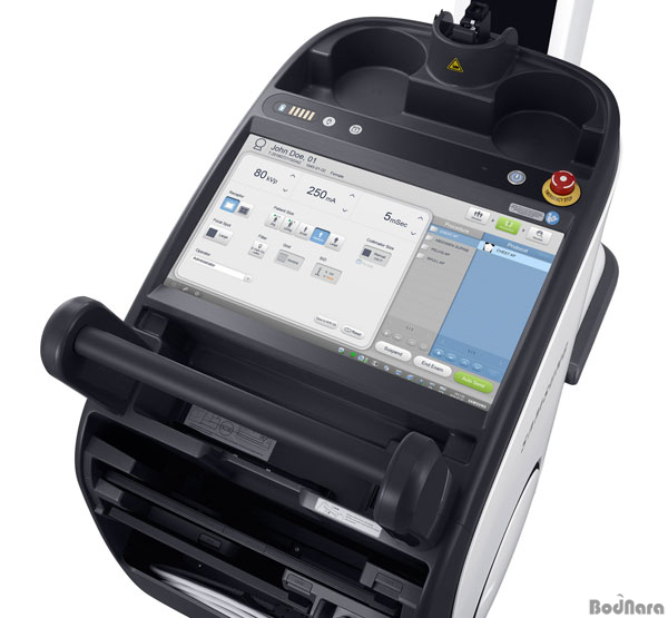 삼성전자, 이동형 프리미엄 디지털 엑스레이 GM85 출시:: 보드나라